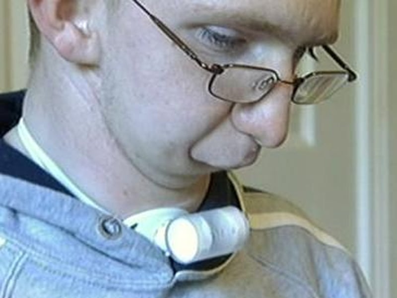 Donegal teen has pioneering jaw operation