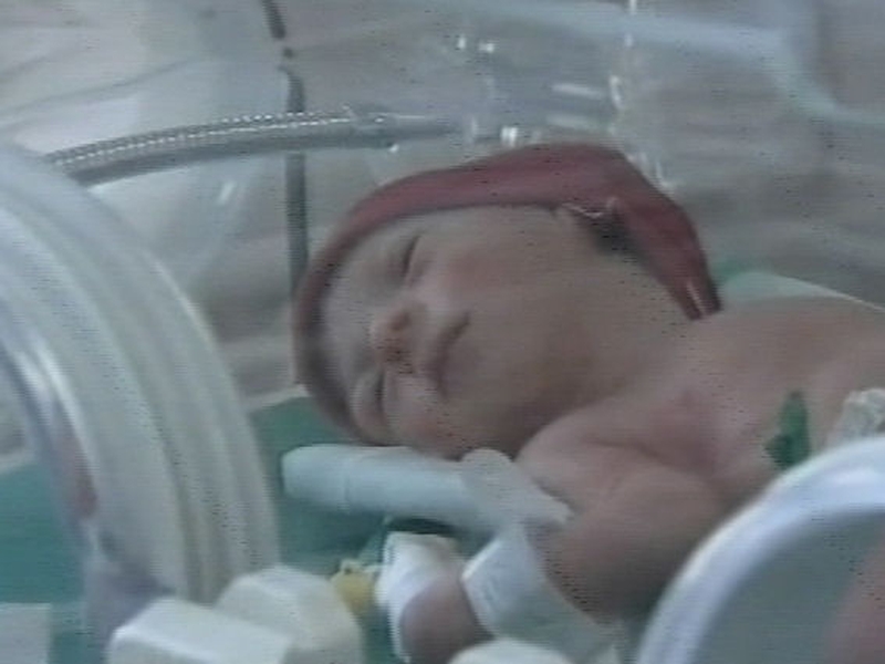 Doctors lose battle to save 'miracle' baby