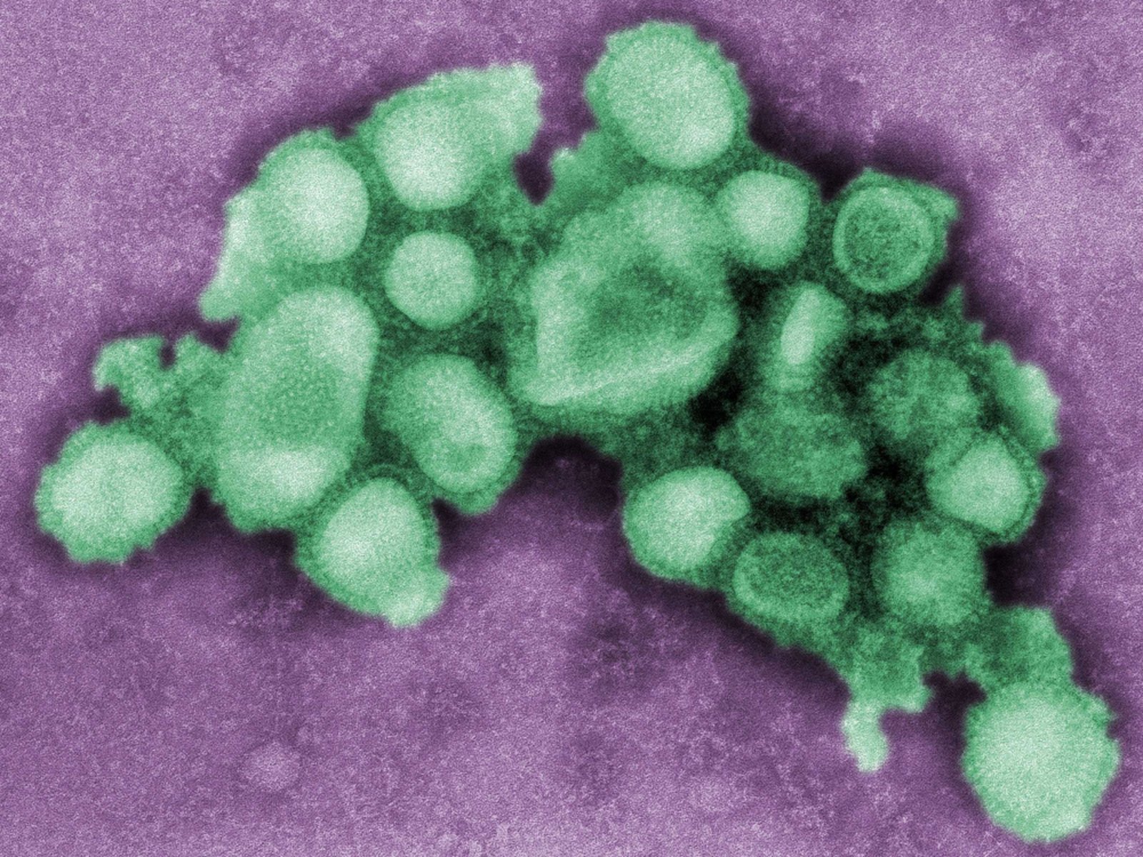 Swine flu confirmed in Ireland