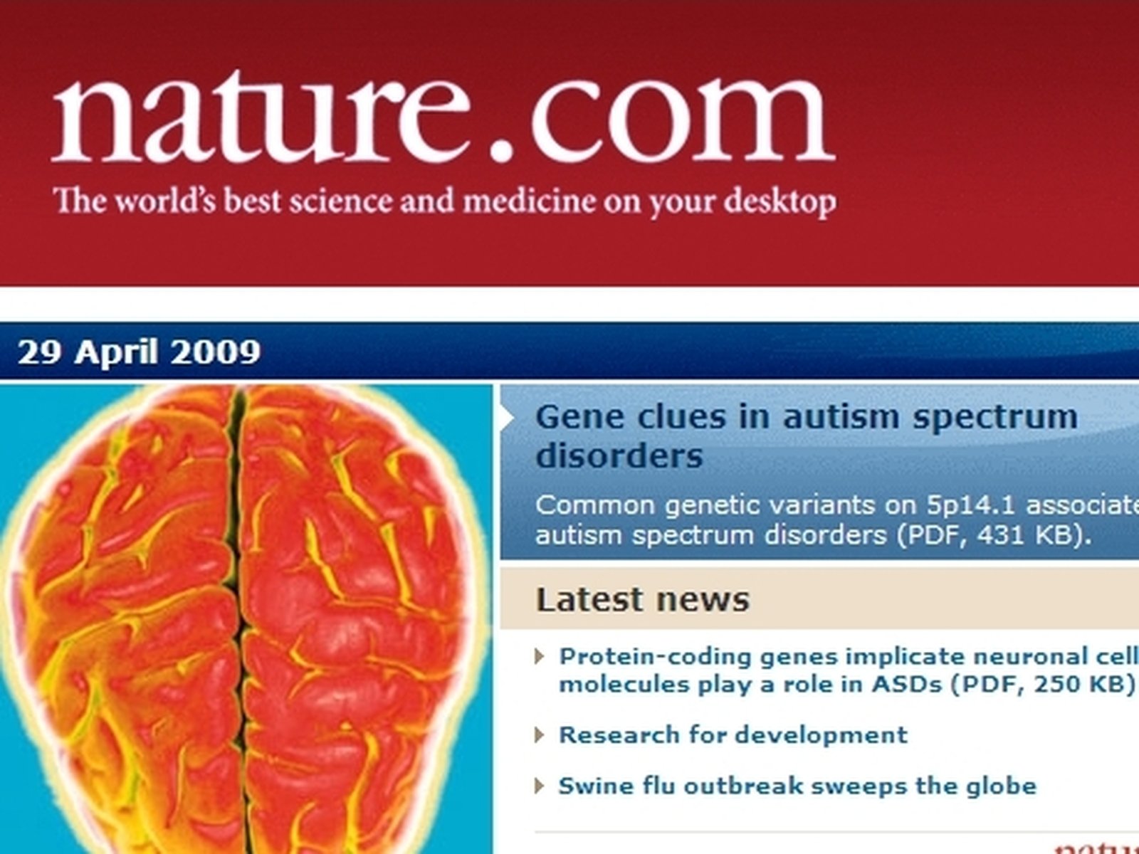 'Breakthrough' in autism research