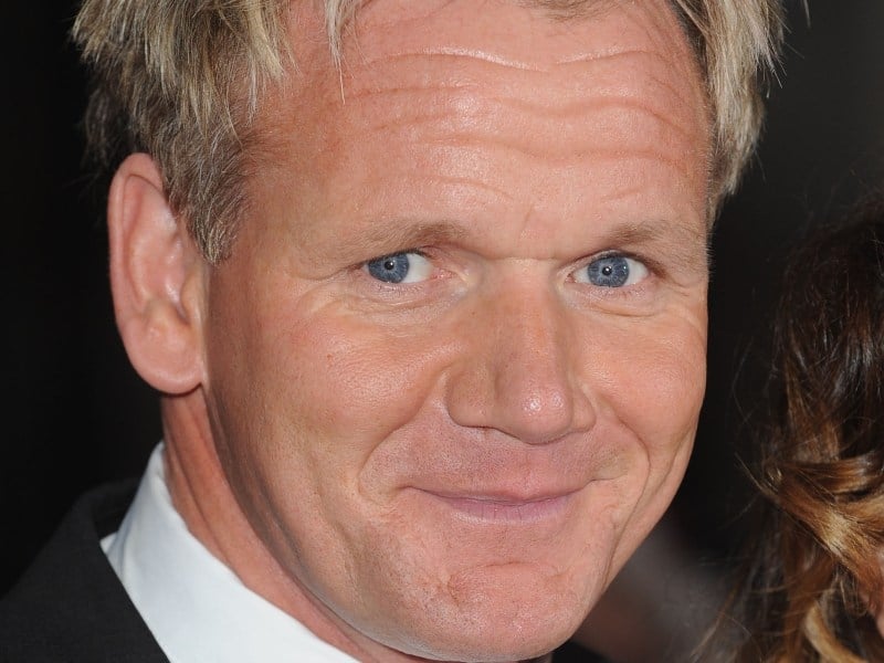 Ramsay admits he had face fillers