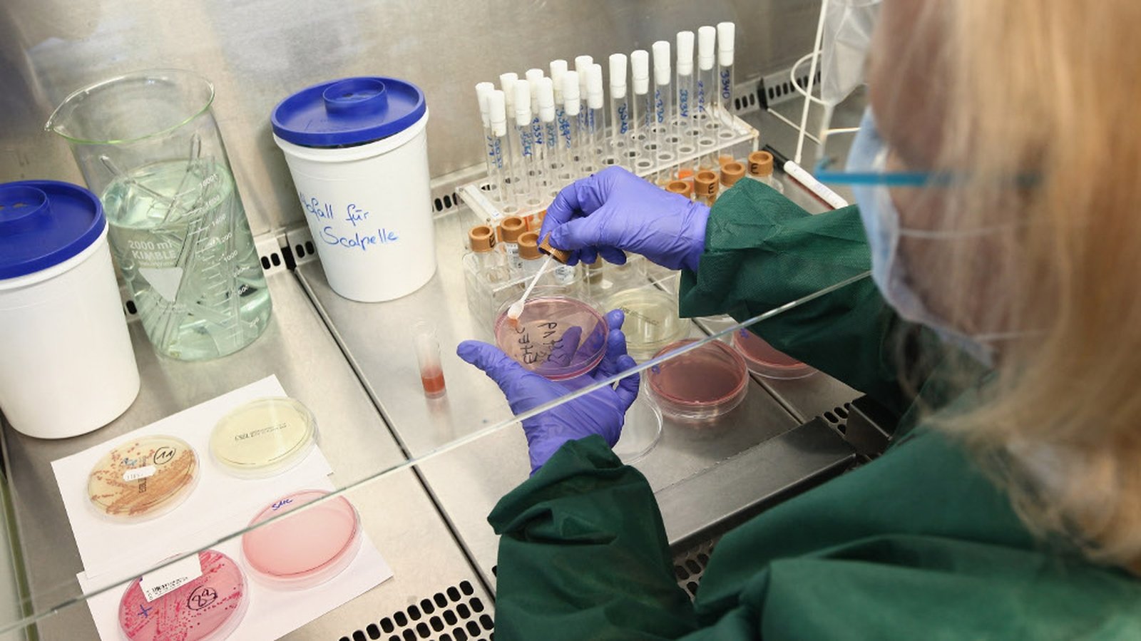 E coli outbreak death toll hits 19