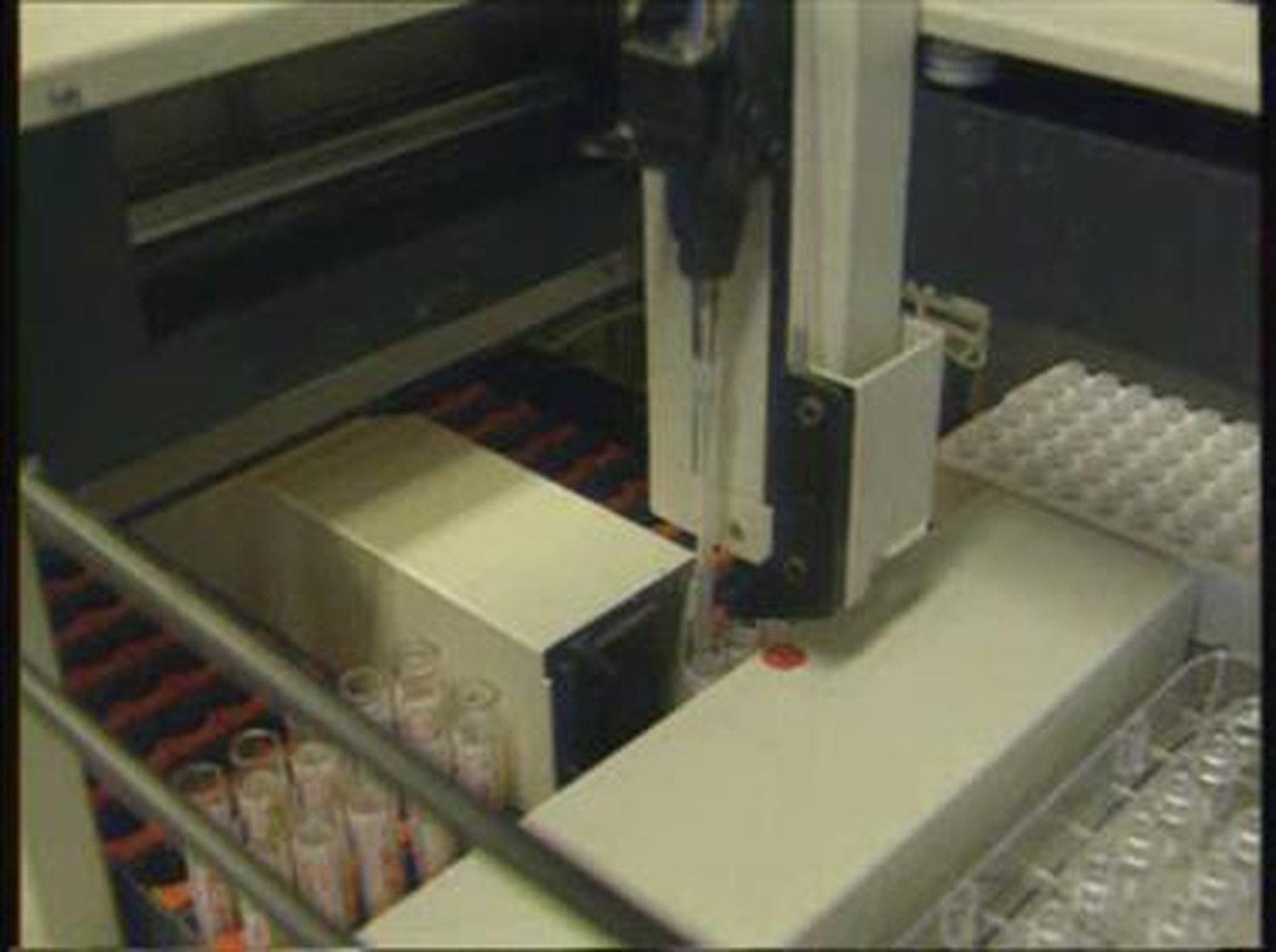 RTÉ Archives | Health | First Test Results of Screening for Hepatitis C ...