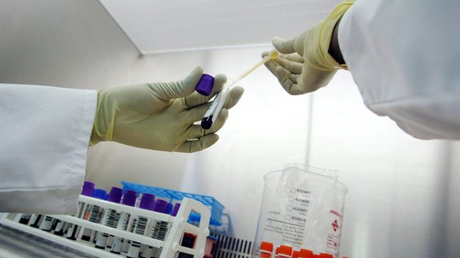 Precautionary recall of chemotherapy drugs