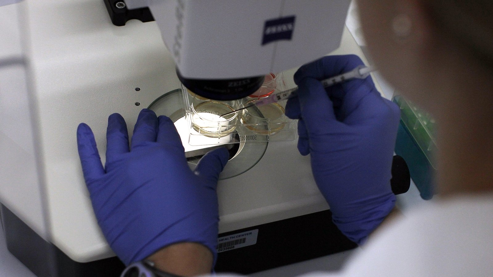 New stem cell technique regenerates eye’s lens