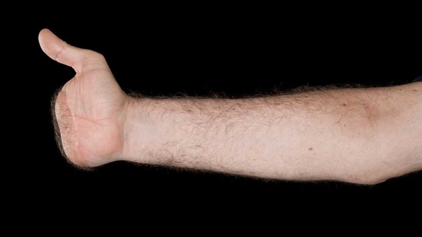 Hand transplant patient feels 'whole again'