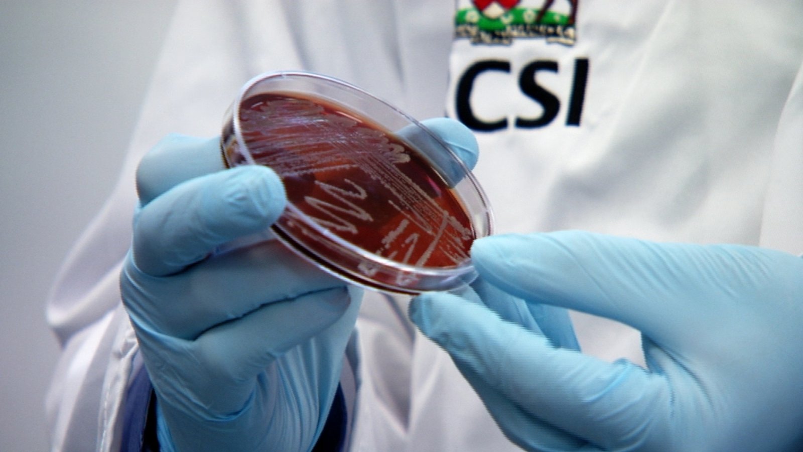 Research shows lack of awareness over sepsis