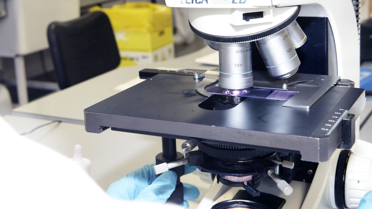 Screening Service raised wider concerns on repeat tests | News At One ...