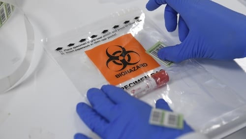 Health Minister defends testing and tracing system