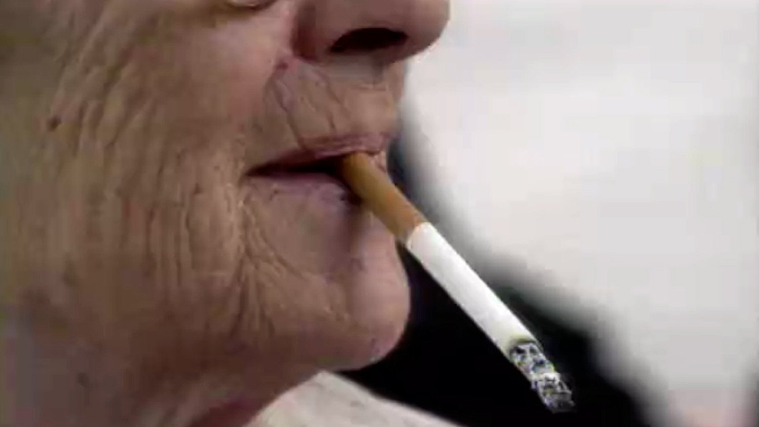 RTÉ Archives | Health | Fight The Smoking Habit