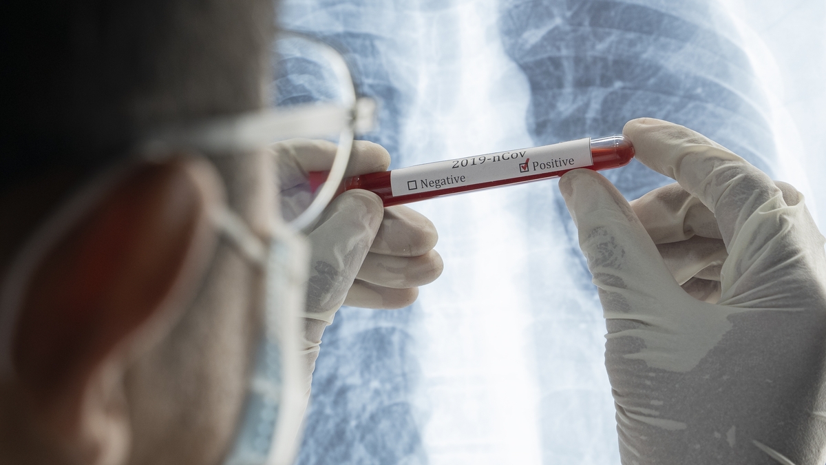 Summer spike in Covid cases | This Week - RTÉ Radio 1