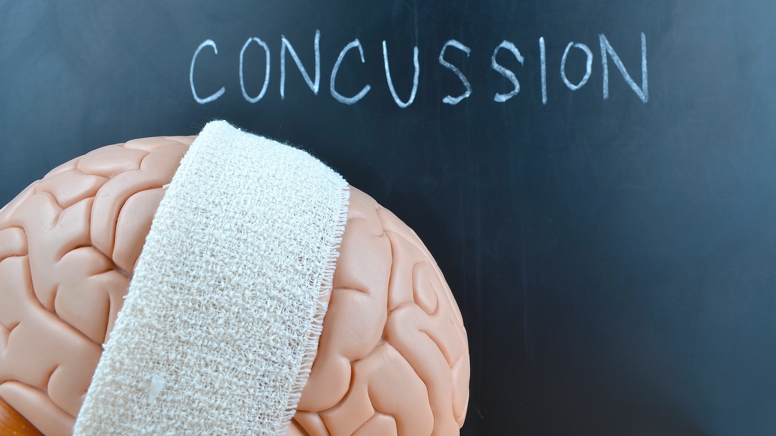 Concussion study finds link to worsened brain function