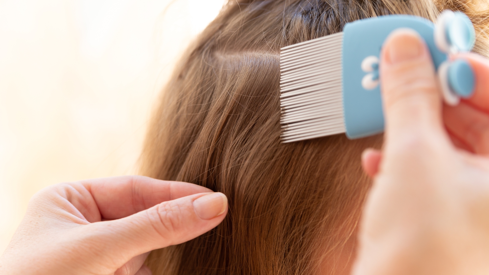 Feeling lousy: How to spot and treat head lice