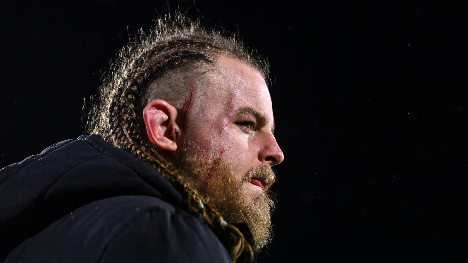 Caulfield red card for stamp on Bealham overturned