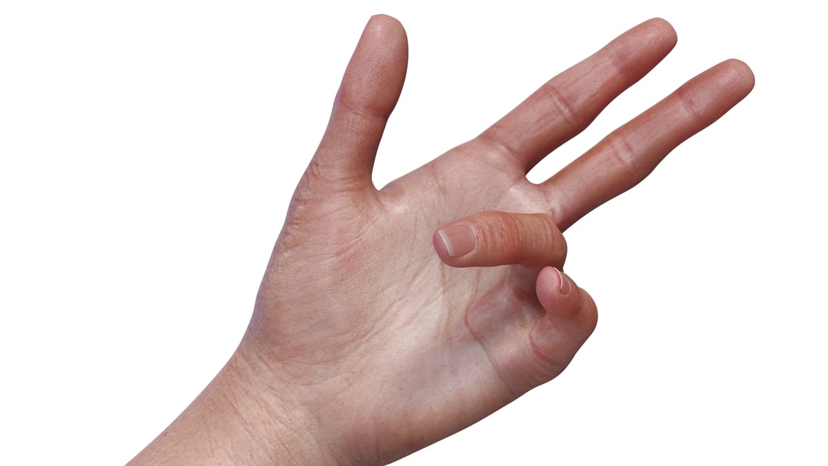 Claw Hand | Liveline - RTÉ Radio 1