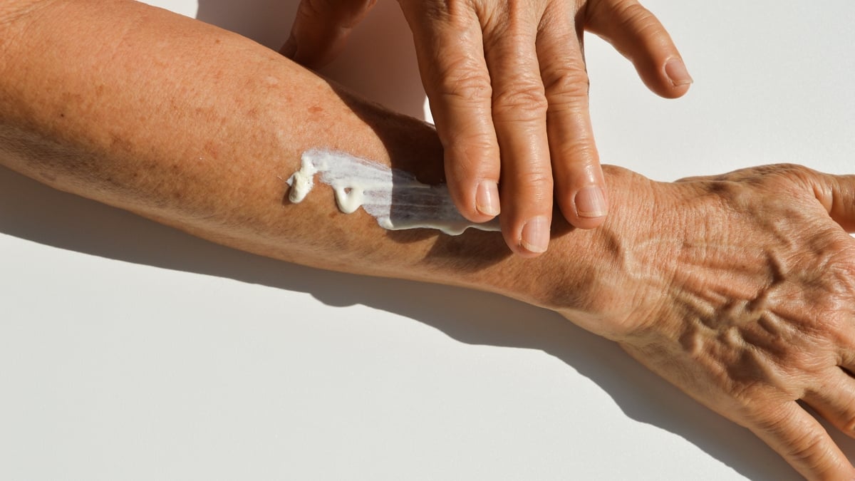 Dermatology expert: Festive skin flare-ups | Today with Claire Byrne ...